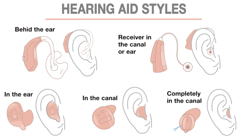 A Guide to In the Ear Hearing Aids | Hearclear