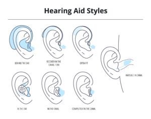 Hearing aids types: what are your options?